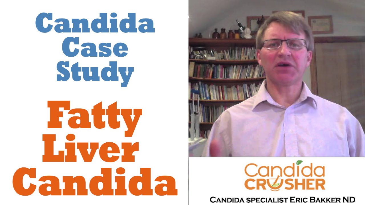 Is Alcohol Consumption Connected to Candida? - YeastInfection.Org ...