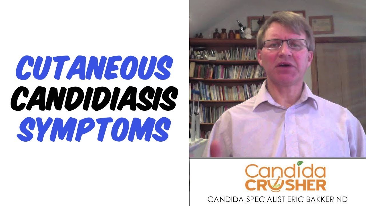 Red and Itchy: Key Symptoms of Cutaneous Candida - YeastInfection.Org ...