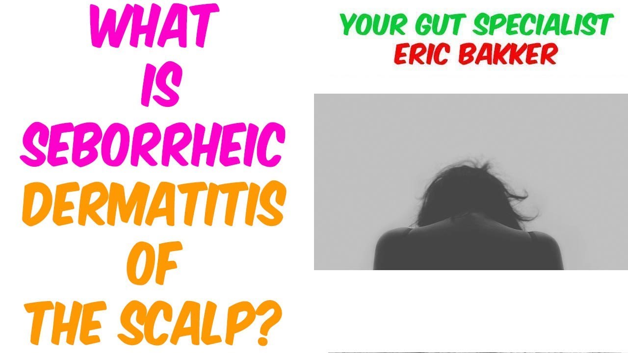 What You Need To Know About Seborrheic Dermatitis Of The Scalp ...